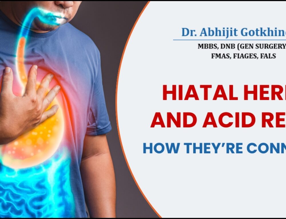 ICD-10 Code for Inguinal Hernia By Dr. Abhijit Gotkhinde