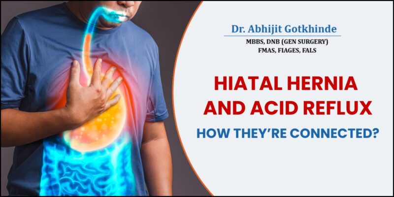 Hiatal Hernia and Acid Reflux: How They’re Connected - Dr. Abhijit ...